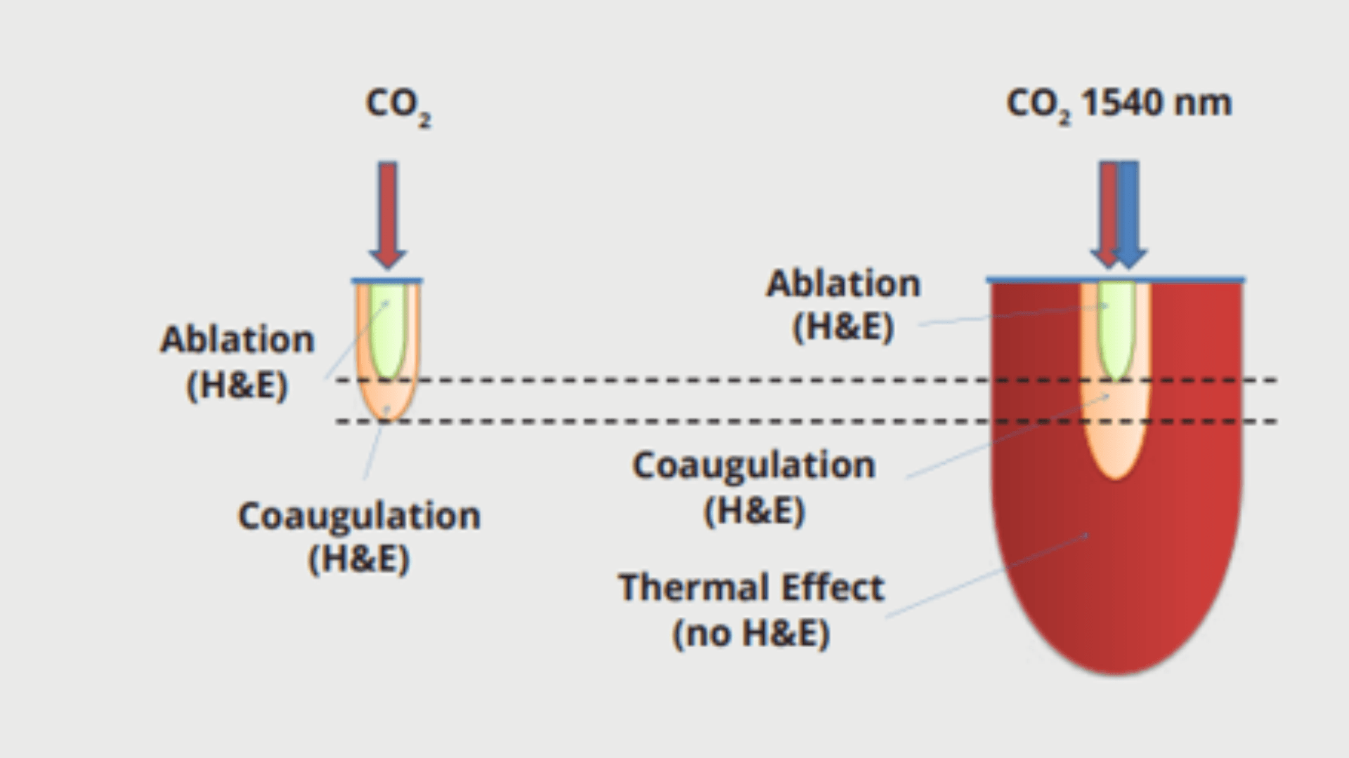 DEKA - DUO GLIDE - Geomedics Pharma