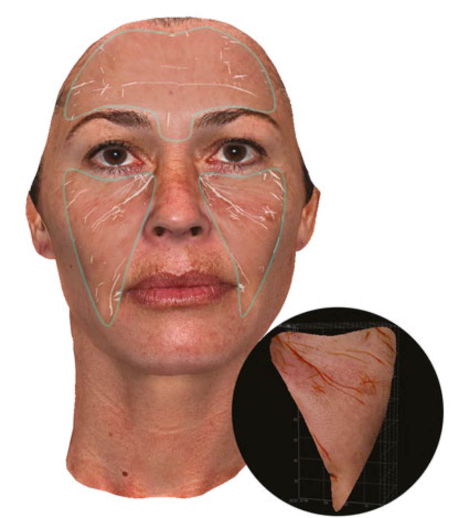 Quantificare - Geomedics Pharma